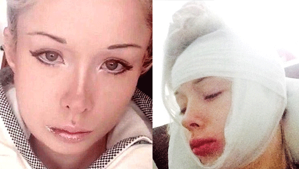 'İnsan Barbie' dayak yedi
