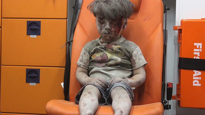 UNICEF İcra Direktörü Lake: Halep'te Ümran gibi 100 binden fazla çocuk var